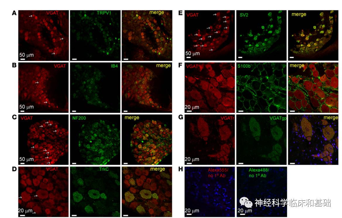 科学网—JCI——背根神经节GABA抑制外周痛觉传入 - 陈之春的博文