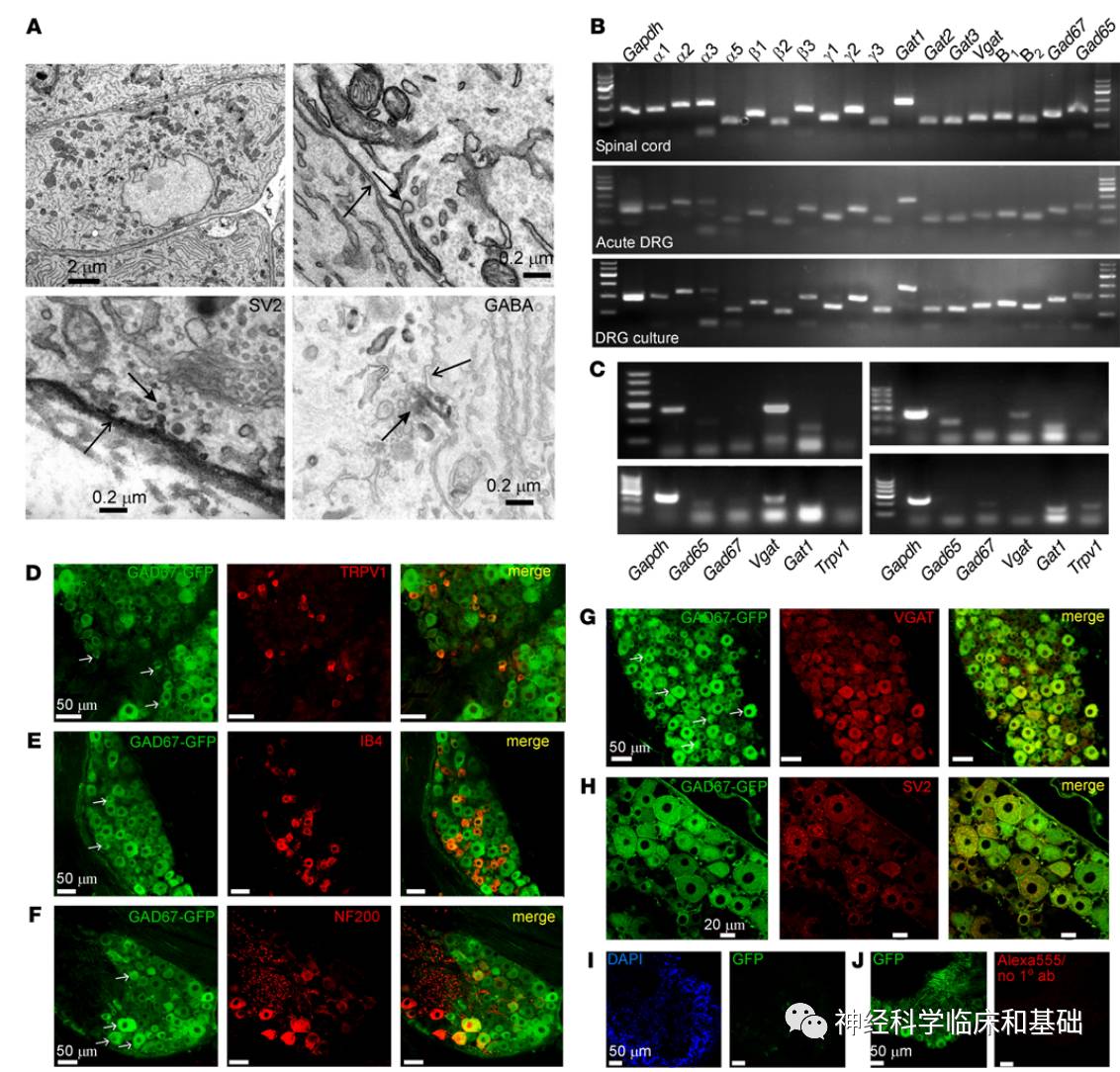 科学网—JCI——背根神经节GABA抑制外周痛觉传入 - 陈之春的博文