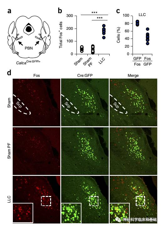 科学网—Nature neurosci——臂旁核的CGRP神经元介导了癌症诱导的厌食 - 陈之春的博文