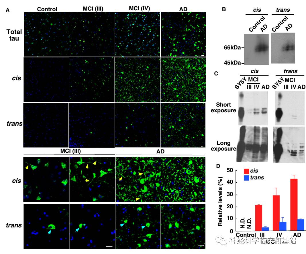 科学网—Cell——Pin1通过促进cis p-tau转变为trans p-tau而预防AD的发生 - 陈之春的博文