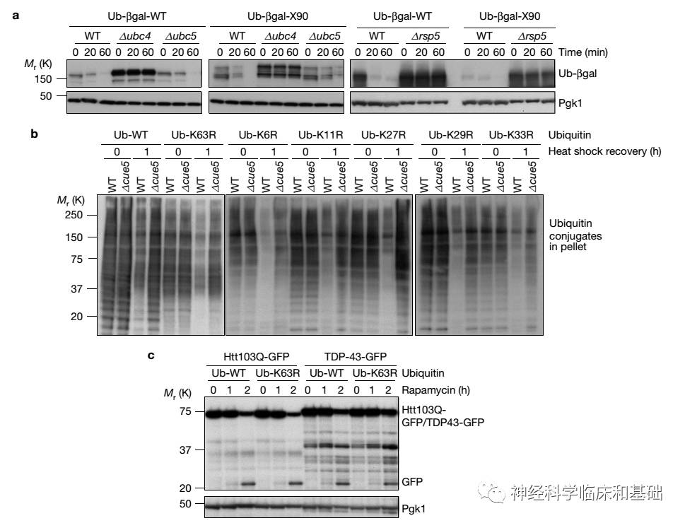 科学网—Nature cell bio—泛素化是蛋白酶体和自噬降解途径的共同信号 - 陈之春的博文