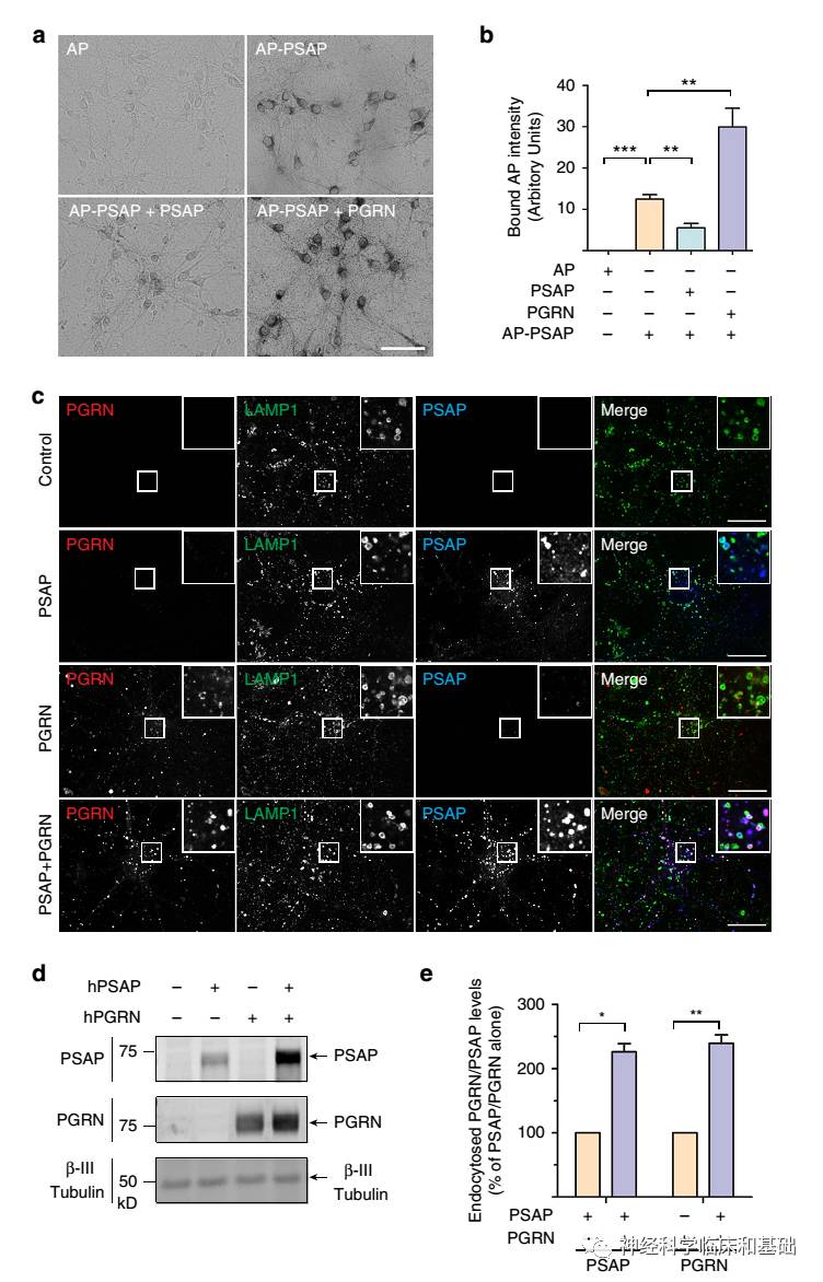 科学网—Nature Communi——额颞叶痴呆PGRN突变导致prosaposin运输异常 - 陈之春的博文