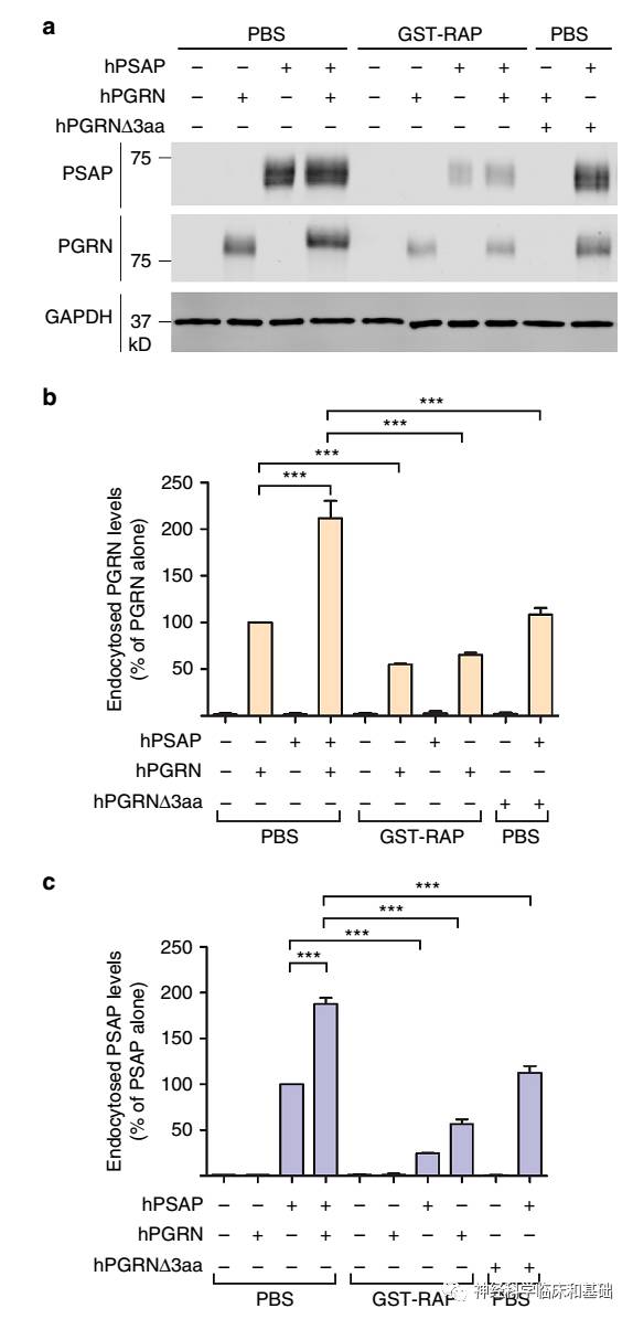 科学网—Nature Communi——额颞叶痴呆PGRN突变导致prosaposin运输异常 - 陈之春的博文