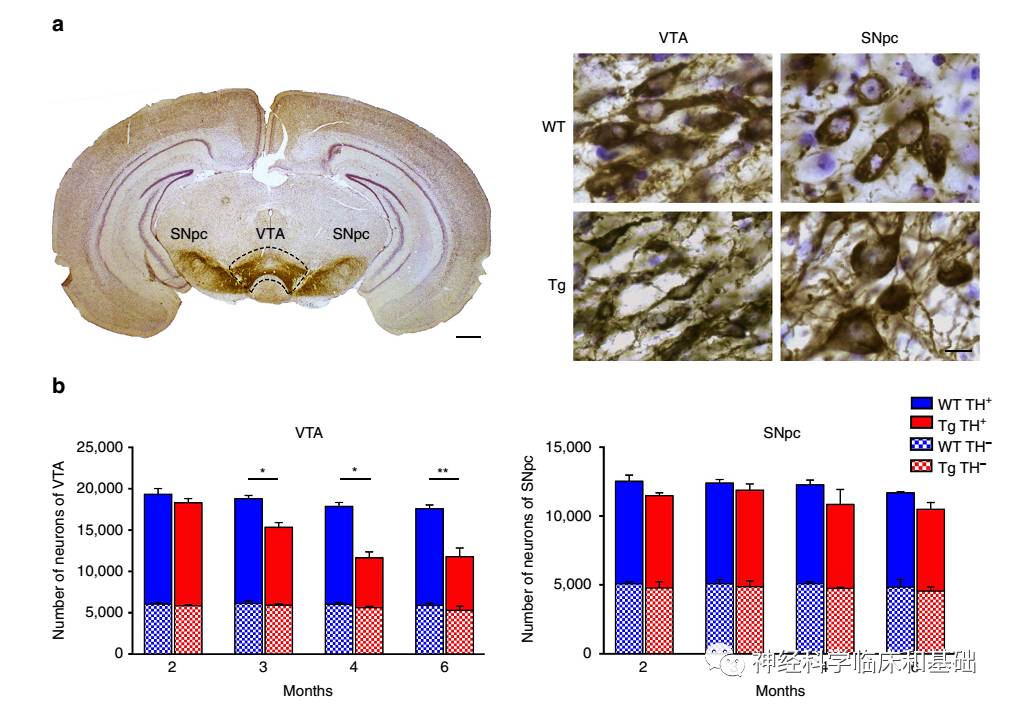 科学网—NMC——VTA多巴胺能神经元丢失参与阿尔茨海默病的发生 - 陈之春的博文